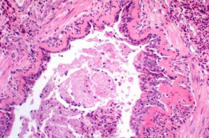 En resa i bilder in i lungans innersta delar – Vetenskap och Hälsa