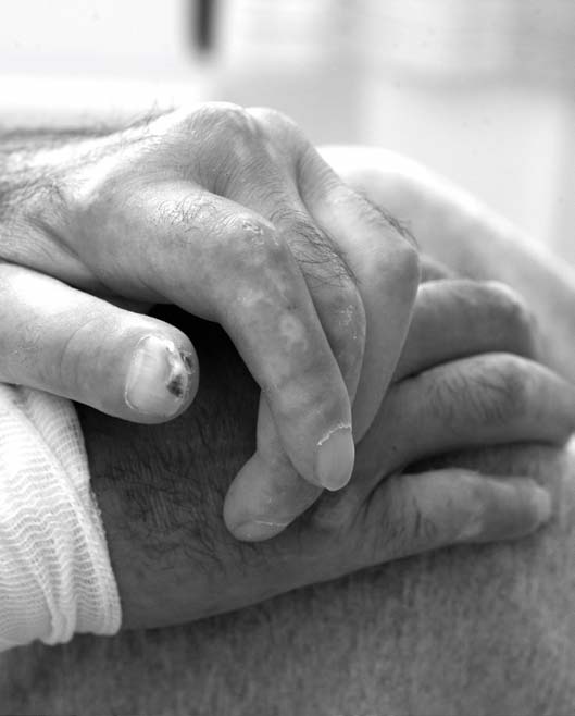 Om systemisk skleros – Vetenskap och Hälsa