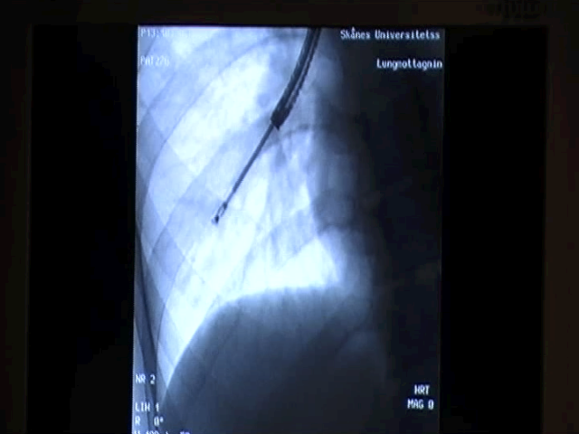 En resa i bilder in i lungans innersta delar – Vetenskap och Hälsa