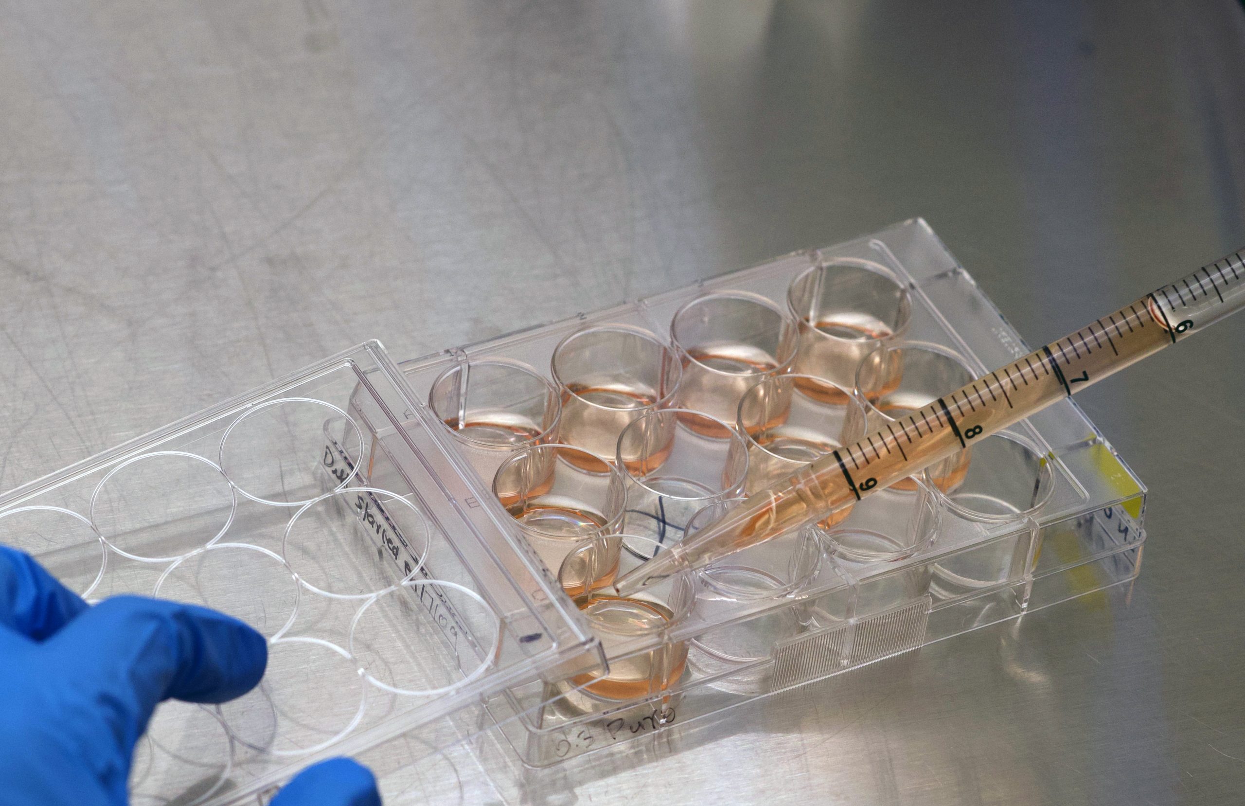 Skräddarsydda celler som fixar insulinet – Vetenskap och Hälsa